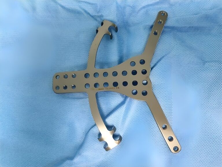 Titanium Sternum 3D Printing: A Life-Saving Innovation - China Custom ...